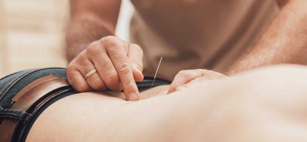 Acupuncture | Odnova Massage Therapy